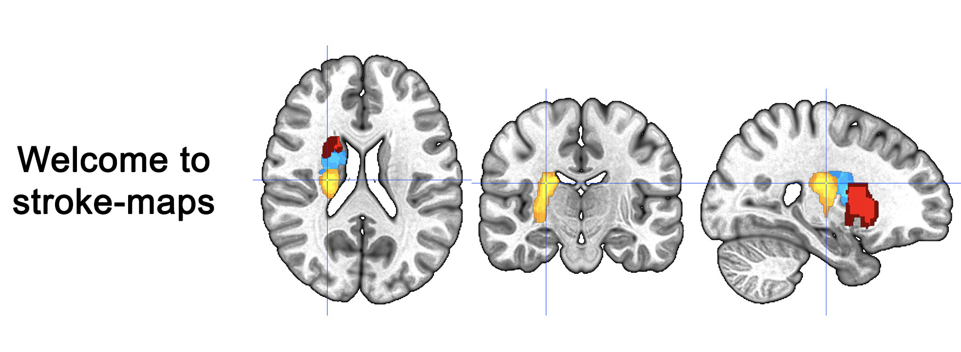 intro1 – Stroke Maps